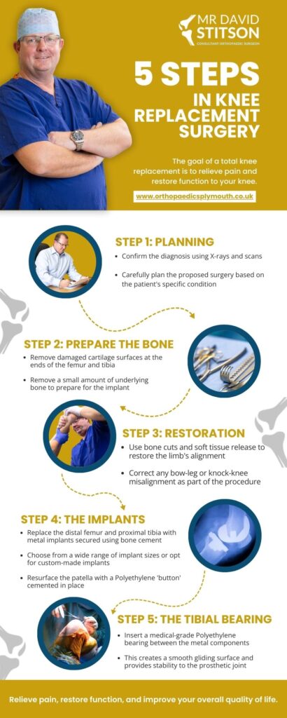 5 Steps In Knee Replacement Surgery You Need To Know
