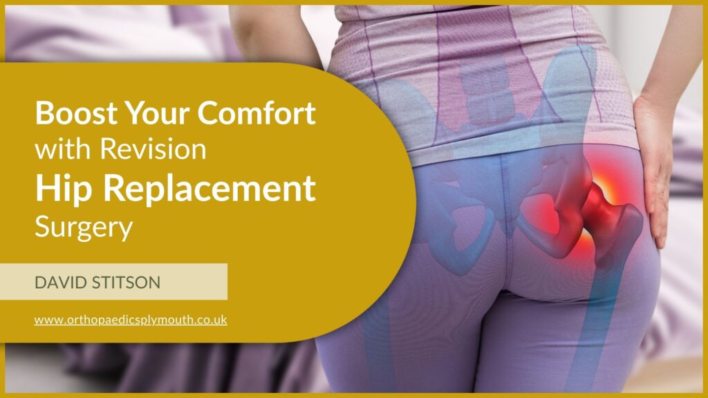 How To Boost Your Comfort | Revision Hip Replacement Surgery